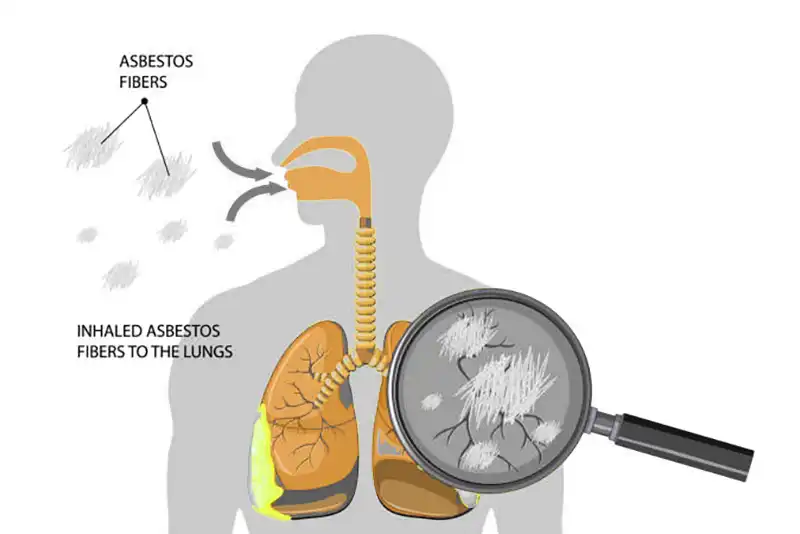 What Happens to Asbestos Once Inhaled or Ingested | 800-519-1440